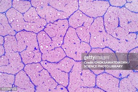 Micrograph Cells Photos And Premium High Res Pictures Getty Images