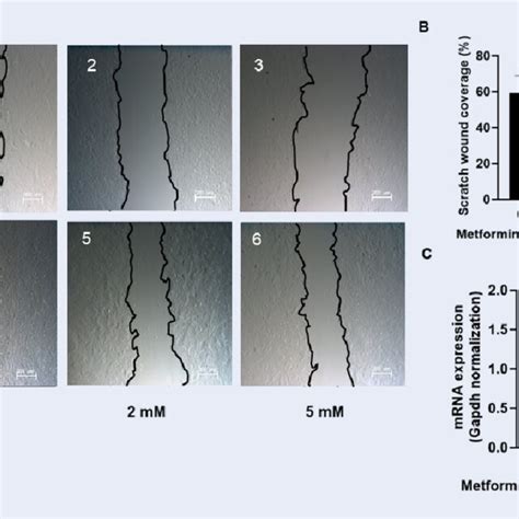 The Proliferation Of 4t1 Mouse Breast Cancer Cells At Four Different Download Scientific
