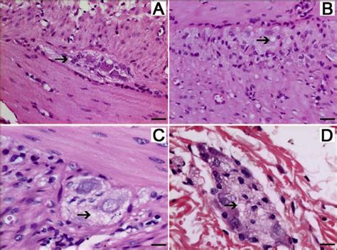 Histologic And Immunohistochemical Evaluation Of Intestinal Innervation