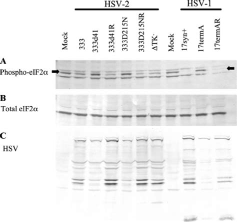 Accumulation Of Phosphorylated Eif2 ␣ Phospho Eif2 ␣ Is Associated Download Scientific
