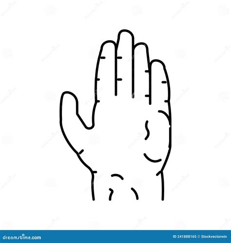 Scleroderma Vector Illustration Autoimmune Skin And Blood Disease