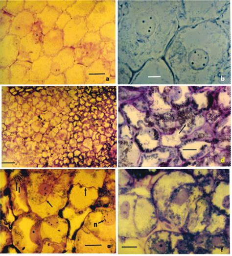 Fresh Endosperm Cells Shows A Relatively Uniform Shape And Size Bar