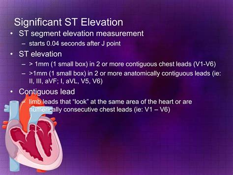 Ecg In Acs Pptx