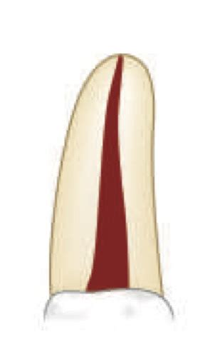 Vertuccis Classification Flashcards Quizlet