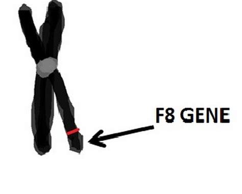 Hemophilia Coagulation Factor Viii