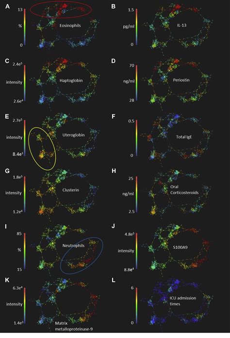 Figure 1 From Stratification Of Asthma Phenotypes By Airway Proteomic Signatures Semantic Scholar