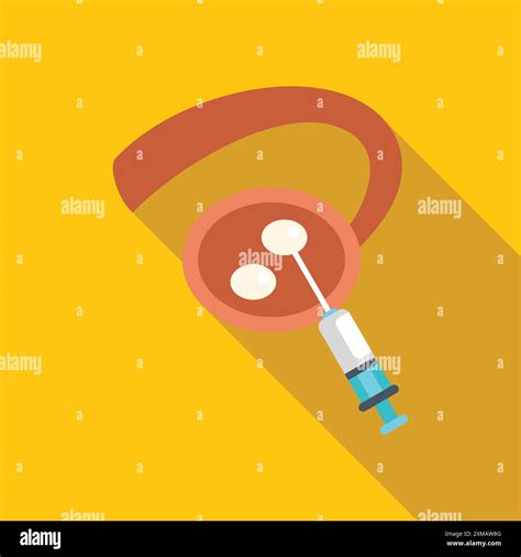 Syringe Being Used To Remove Egg Cell From Ovary For In Vitro Fertilization Procedure Stock