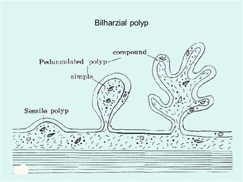 Bilharziasis Common Schistosomiasis Strains Comment Distribution Ppt Download