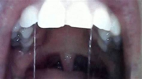 Tonsil Endoscopy Angiejoy Clips4sale