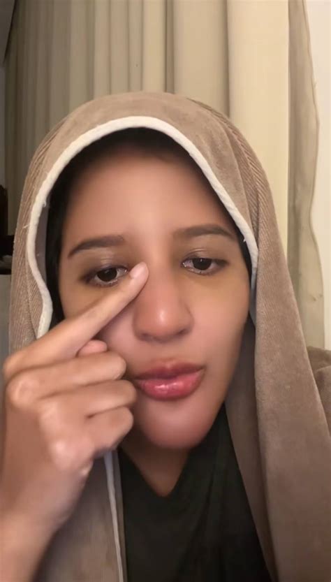 Hidung Dan Dagu Jadi Senget Isteri Azlan Komeng Akui Terseksa Buang