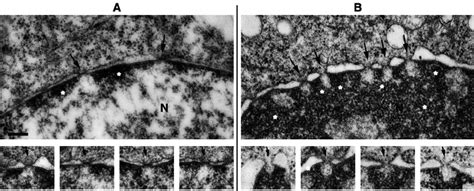 Electron Microscopy Of Nuclear Envelope And Nuclear Pores Of Uninfected Download Scientific