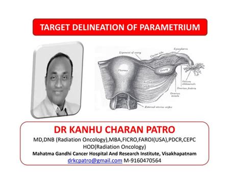 Target Delineation Of Parametrium Pptx
