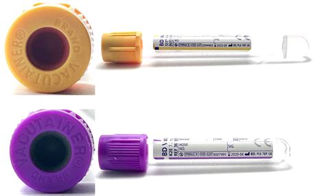Rare Or Imported Diseases Rcht Pathology