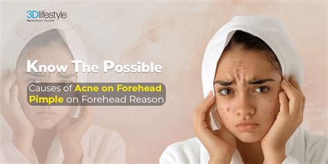 Know The Possible Causes Of Acne On Forehead Pimple On Forehead