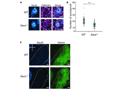 Reduction In Purkinje Cell Puncta In Cerebellar Nuclei Cn In Sacs Download Scientific