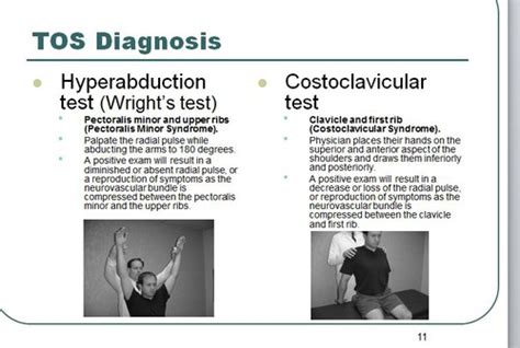 Costoclavicular Test