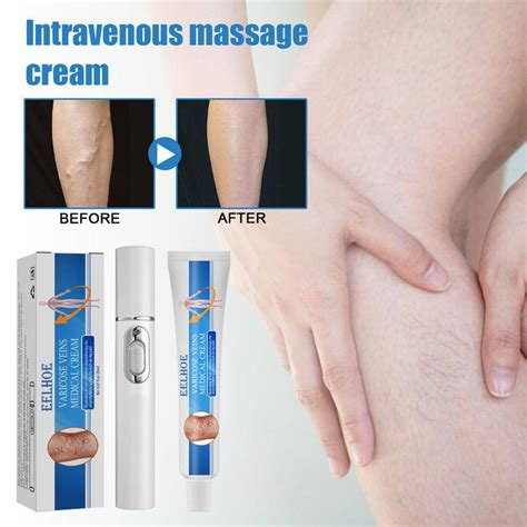 Eelhoe Varicose Veins Relief Cream Vasculitis Phlebitis Spider Pain