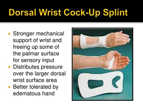 Ppt Upper Extremity Orthosis Static And Dynamic Powerpoint