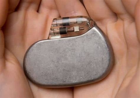 Choosing Not To Replace A Pacemaker Battery Things To Consider