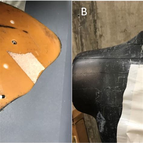 A Section 9 Of Rando Phantom Shows The Two Drilled Holes And A Download Scientific Diagram A Section 9 Of Rando Phantom Shows The Two Drilled Holes And A Download Scientific Diagram