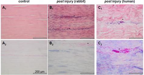 Figure 1 From Decellularized Tendon Extracellular Matrix—a Valuable