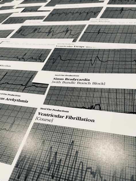 Acls Rhythm Strips Flashcards Free Acls Practice Test 2025 Official