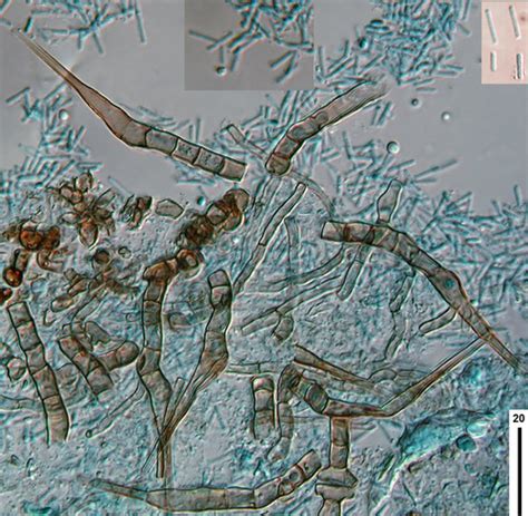 Chalara Dualis · Inaturalist