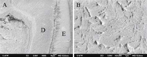 A Scanning Electron Microscope Sem Pictures Show The Enamel E And Download Scientific