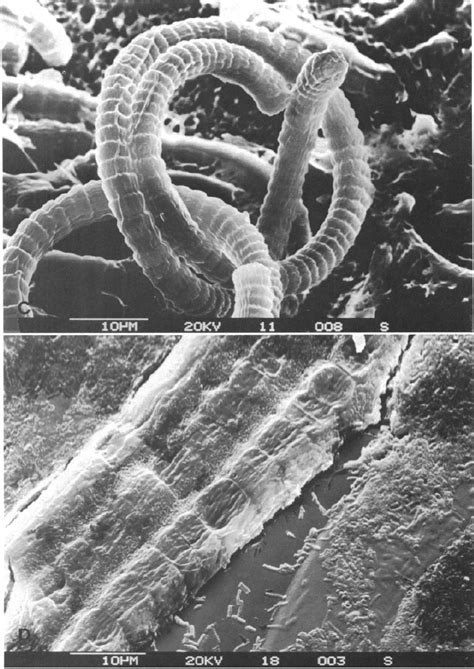 Morphology Of Spirulinaarthrospira C Scanning Electron