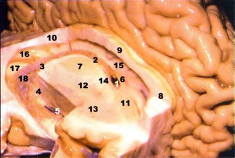 Pecten Del Pubis Un Vistazo Detallado Al Pecten Pubis E Anatomy