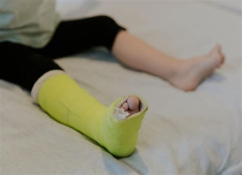 Stress Fractures Symptoms Causes And Effective Treatments