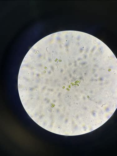 Freshwater Algae Identification Flashcards Quizlet