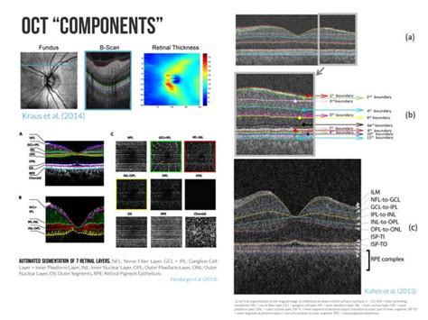 Shallow Introduction For Deep Learning Retinal Image Analysis Pdf Eye And Vision Conditions