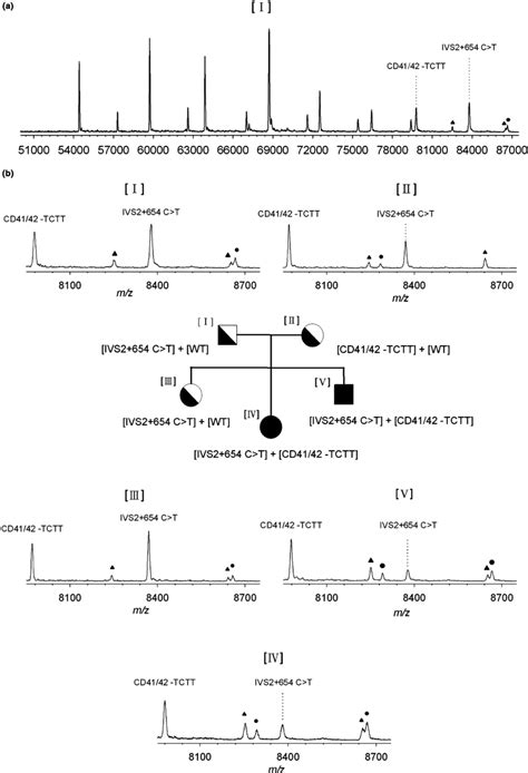 Genotyping Of Hereditary B Globin Hbb Gene Mutations In A Core