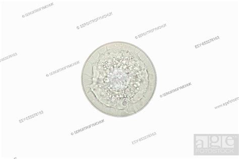 Freshwater Phytoplankton Round Diatom Algae Stephanodiscus By