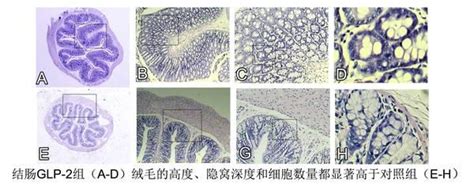 应激性溃疡的症状图片应激性溃疡图片大全应激性溃疡39疾病百科