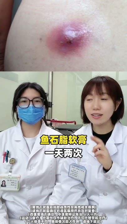 挑战不开 很贵的药 看看你记住了多少湿疹 皮炎 神经性皮炎 肛周湿疹 健康科普 Youtube