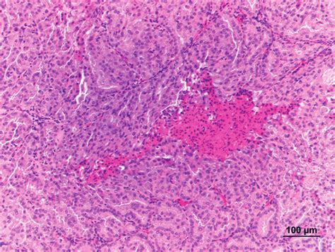 Detail From Figure 2 Showing The Population Of Basophilic Cells With