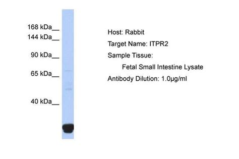 Invitrogen Ip3 Receptor 2 Polyclonal Antibody 100 μl Unconjugated