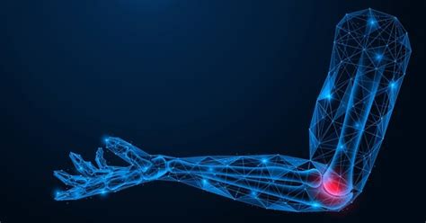 102 Dislocation Elbow Joint Stock Vectors And Vector Art Shutterstock