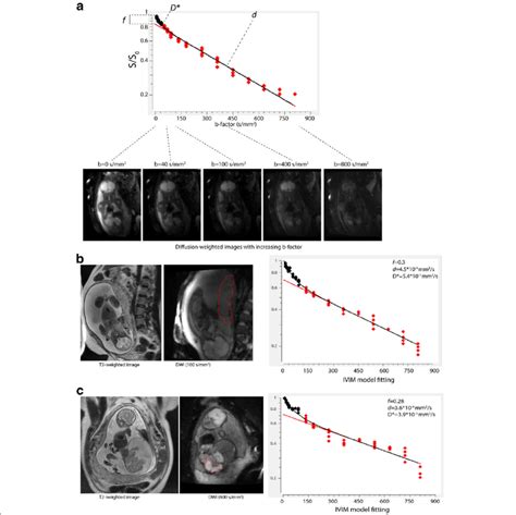 Ivim Imaging In Utero A Bi Exponential Model Fitting On The Dwi