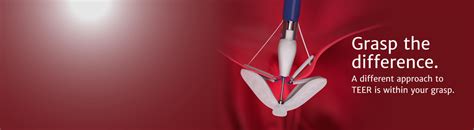 The Pascal Precision System Edwards Lifesciences