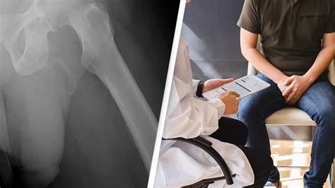 Doctors Discover Mans Penis Is Turning Into A Literal Bone Due To Rare Condition