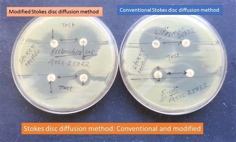 Stokes Method Introductiontypes Principle Procedure And Result Interp