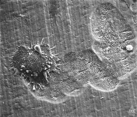 Osteoclast Osteoclast Microscopic Photography Anatomy Bones