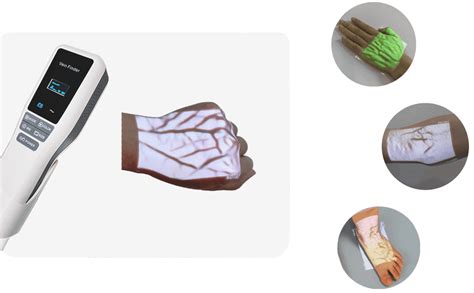 What Is Near Infrared Vein Finder
