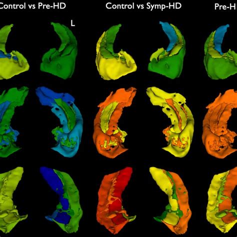 The Hippocampal Perforant Pathway The Hippocampal Afferent White