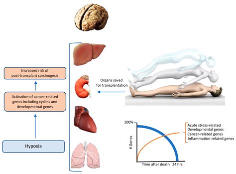 ijms free full text induced coma death and organ transplantation