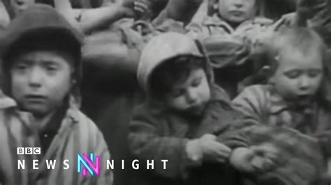 Josef Mengele Twins Sewn Together The Story Of Twins Who Endured Josef