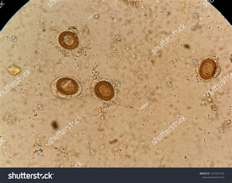 58 Taenia Spp Egg 이미지 스톡 사진 및 벡터 Shutterstock